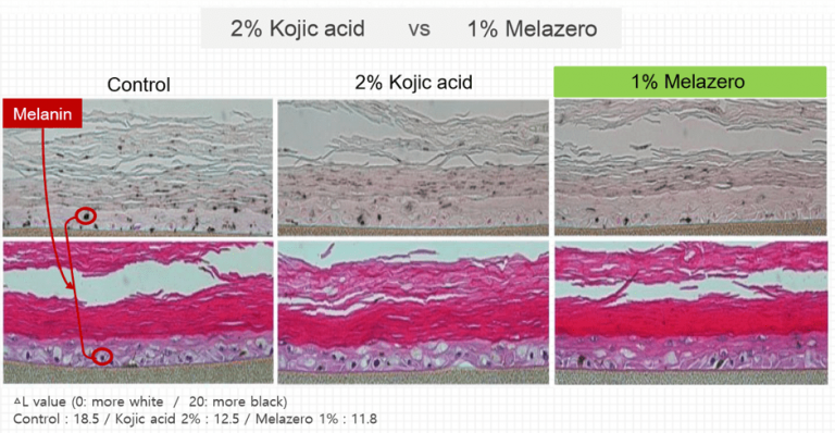 Melazero, Bahan Aktif Brightening untuk Kulit Kusam